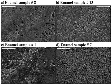 sem micrographs showing a type 4 etch pattern b type 5 etch