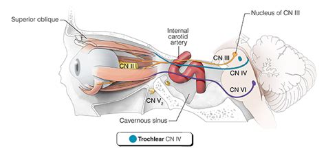 Trochlear Nerve