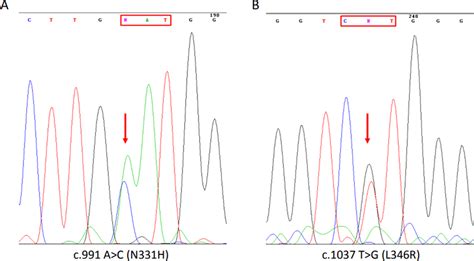 Electropherograms Of Sequencing Analysis At The Thrb Gene Exon 9 In