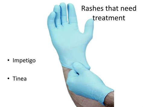 Pediatric Rashes PPTX