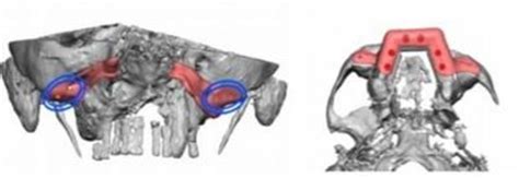 Cutting Guide For Maxillectomy And Positioning Guide For The Download Scientific Diagram