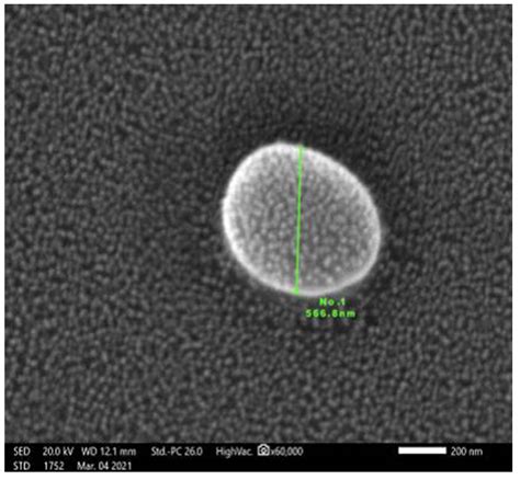 Interspecies Interaction Between Pseudomonas Aeruginosa Staphylococcus