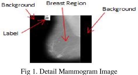 figure 1 from classification of breast cancer using local binary