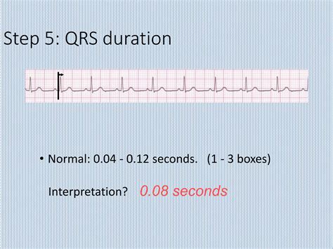 Interpretation Of ECG Lab Session Ppt