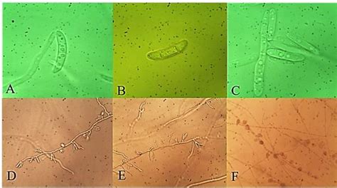 Figure 2 Fusarium A C Microconidia And Macroconidia D E Hyphae