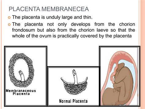 Abnormalities Of Placenta And Cordpptx