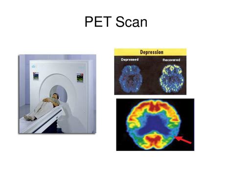PPT Medical Imaging PowerPoint Presentation Free Download ID