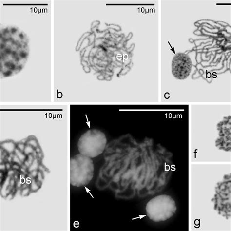 Subsequent Stages Of Meiotic Prophase I Visualization Of Chromosomes