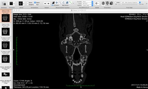 2 slice function in dicom viewer left and in unity right