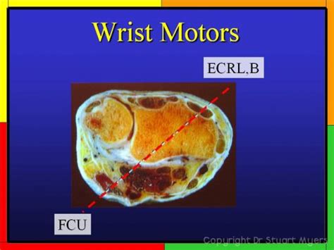 Dart Throwing Motion