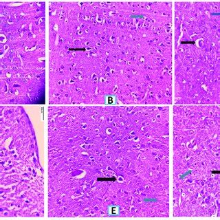 Histopathology Of Rat Brain Cerebral Cortex Section With H E 400 Download Scientific