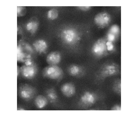Cell Segmentation Steve On Image Processing With Matlab Matlab