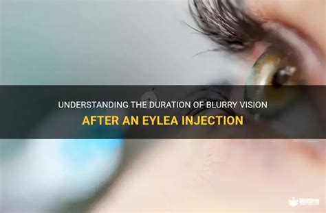 Understanding The Duration Of Blurry Vision After An Eylea Injection Medshun