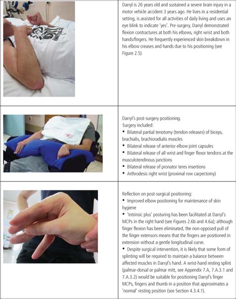The Hypertonicity Intervention Planning Model For Upper Limb