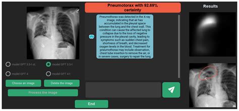 Using Segmentation To Boost Classification Performance And