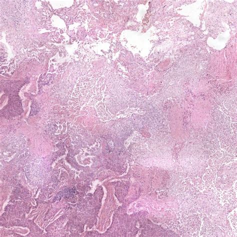 Fraction Of Label Appearance In The Segmentation Masks With 5 Classes