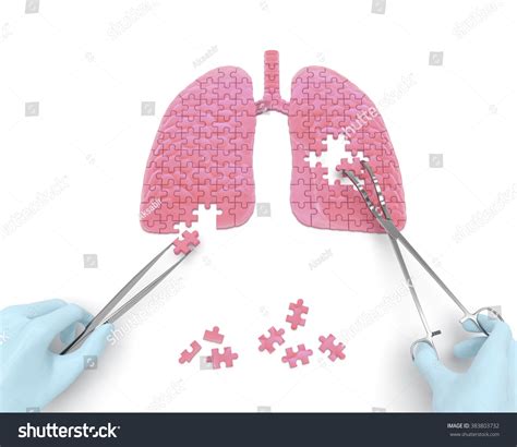 Lungs Operation Puzzle Concept Hands Surgeon Stock Illustration