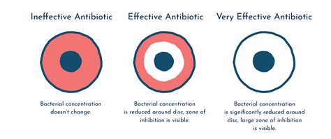 Dr Raj Patel On Interstitial Cystitis Testing And Recurrent Uti Live
