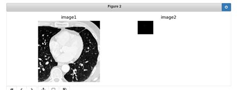 Resample To Same Spacing And Size And Align To Same Origin Beginner