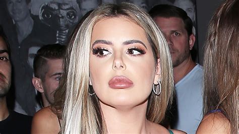Brielle Biermann Reveals She Had Double Jaw Surgery See The Photos Hollywood Life