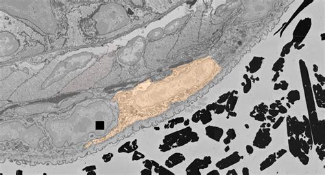 Gzip Compressed Data Is Corrupt Issue Mobie Platybrowser Project GitHub