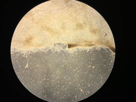 Are These Ipscs Or Not Why Cells Are Detaching During Reprogramming