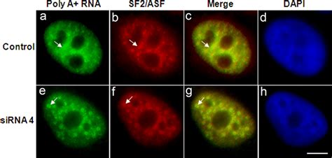 Sirna Mediated Depletion Of Son Alters The Localization Of Nuclear Download Scientific Diagram