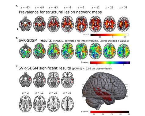 Support Vector Regression Structural Disconnection Mapping For