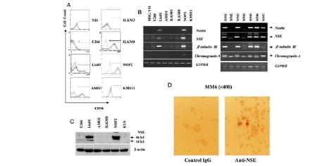 Cd56 Expression Combined With The Expression Of Neuronal Cell Markers