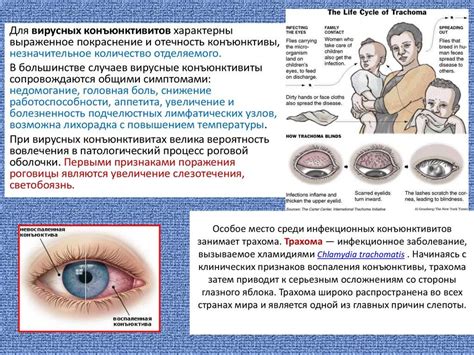 Профилактика конъюнктивита у детей и взрослых основные правила