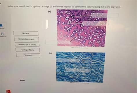 solved label structures found in hyaline cartilage a and