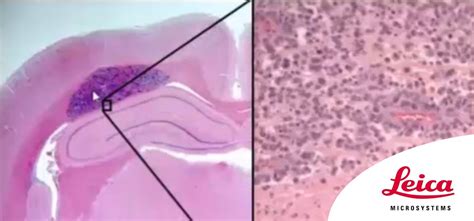 Fundamentals Of Fluorescence Microscopy Microscopy Focus