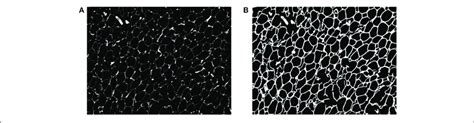 a the image after illumination correction b binary image after