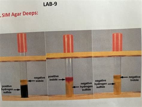 SIM Agar Deeps Flashcards Quizlet