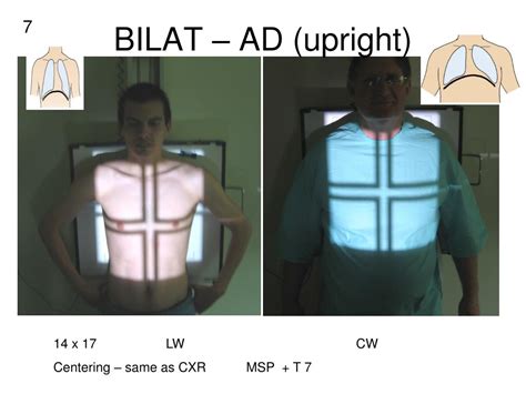 Ppt Pa Anterior Side Best Seen Ap Posterior Side Best Seen