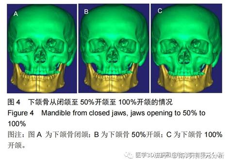 颞下颌关节有限元模型的生物力学特征 知乎
