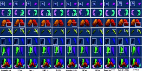 3d brain structure segmentation visualization comparing the proposed