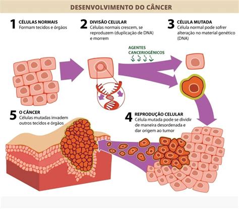 Câncer Colorretal Ccr Fisiopatologia