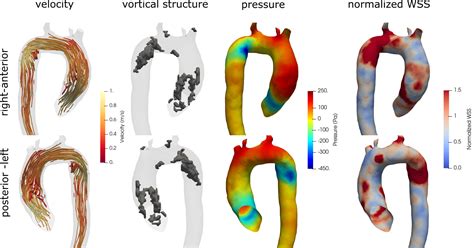 Vlachos Research Group Wall Shear Stress Estimation For 4d Flow Mri Using Navier Stokes