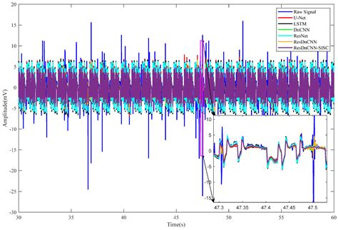 Remote Sensing Free Full Text Noise Attenuation For Csem Data Via Deep Residual Denoising