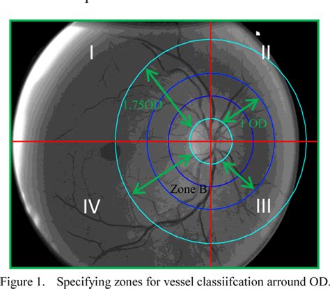Figure 1 From Automatic Retinal Vessel Classification Using A Least Square Support Vector