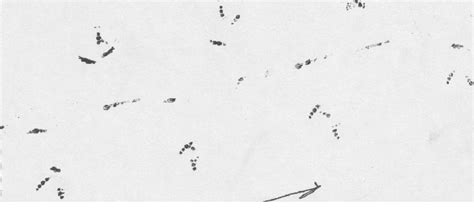 Figure 1 From Footprint Identification Of Weta And Other Insects Semantic Scholar