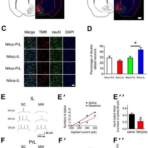 Neuronal Excitability Of Layer 5 Pyramidal Neurons In Il Is Decreased