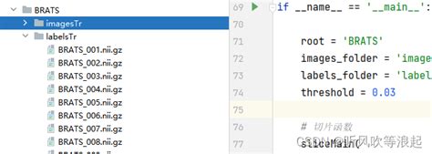 基于unet的brats 3d 脑肿瘤医学图像分割，从niigz文件中切分出2d图片数据brats2020unet分割 Csdn博客