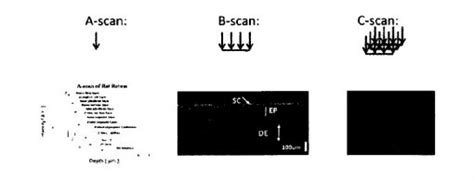Optical Coherence Tomography Oct — Matlab Number One