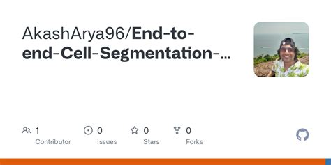 Github Akasharya96end To End Cell Segmentation Using Yolov8