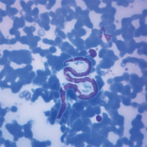 Slide De Dirofilaria Immitis Frontiers Heartworm Disease