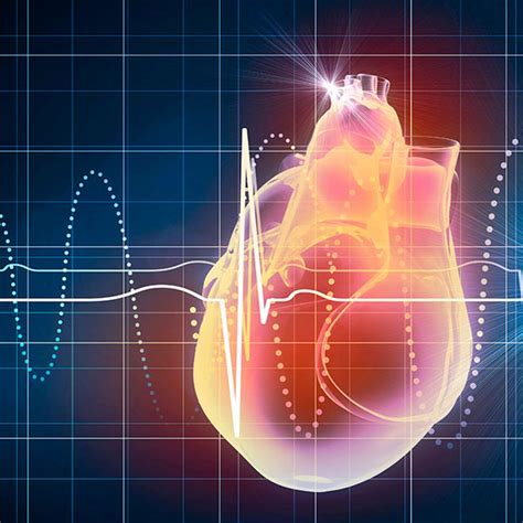 ☑ Dr Alberto Mata Jiménez Electrocardiograma De 12 Derivaciones
