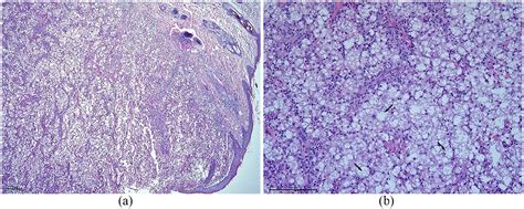Feline Cutaneous Nodular And Ocular Cryptococcus Neoformans In Belgium