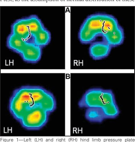 Figure 1 From Accuracy Of Pressure Plate Kinetic Asymmetry Indices And Their Correlation With